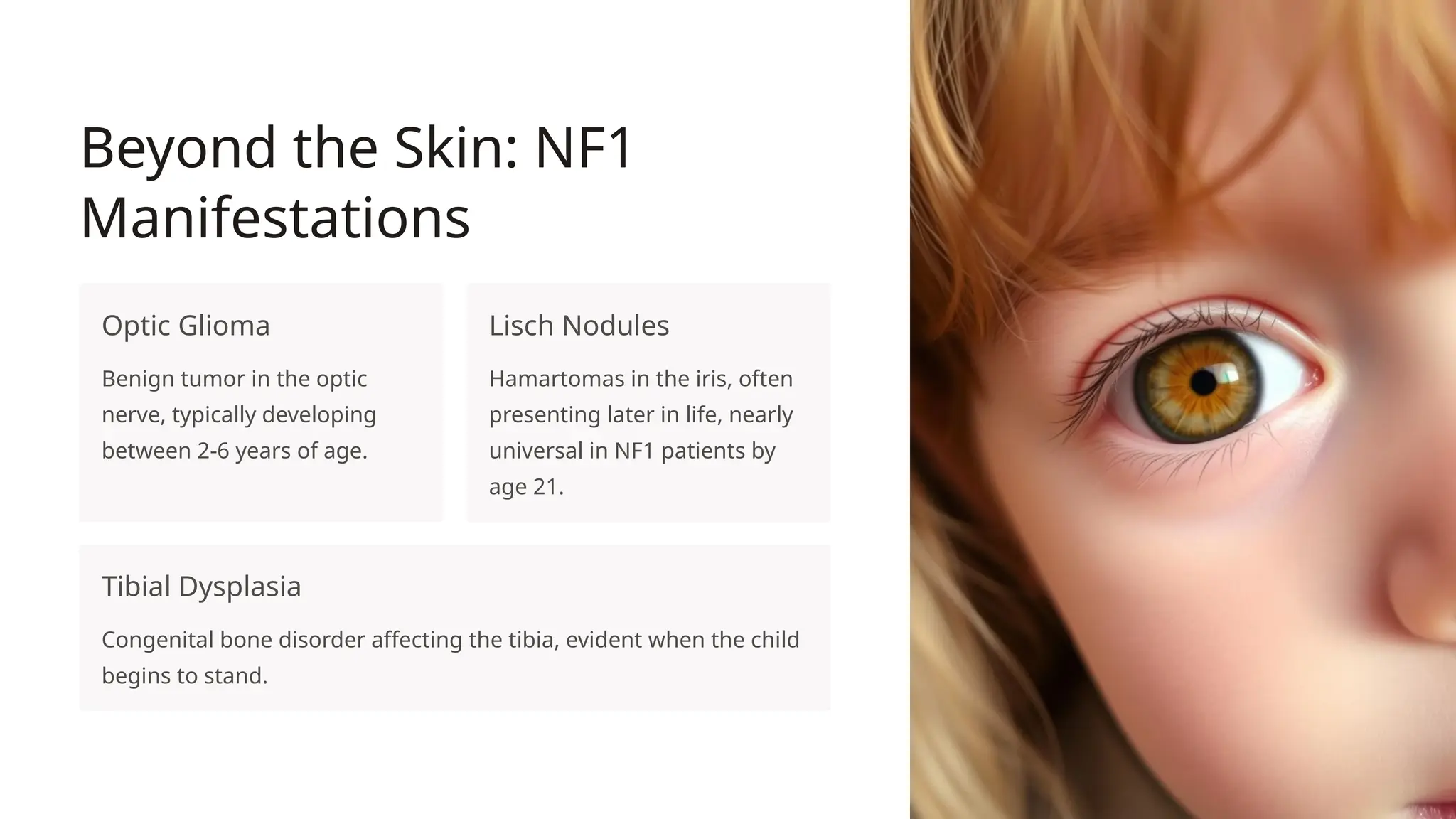 Understanding-Neurocutaneous-Syndromes.pptx