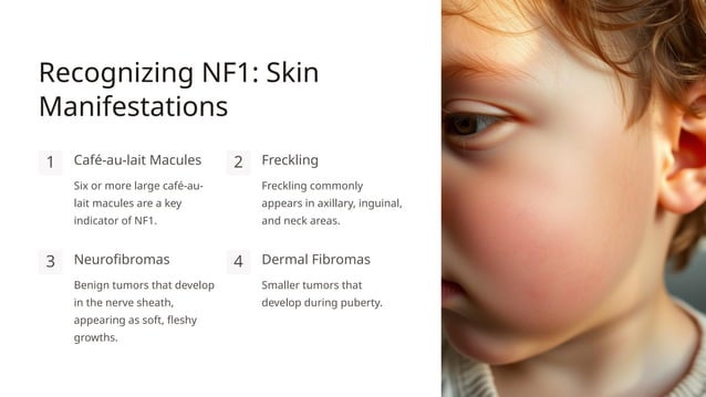Understanding-Neurocutaneous-Syndromes.pptx
