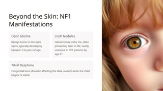 Understanding-Neurocutaneous-Syndromes.pptx