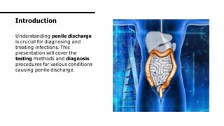 understanding-penile-discharge-testing-and-diagnosis-20240115045012vWoT ...