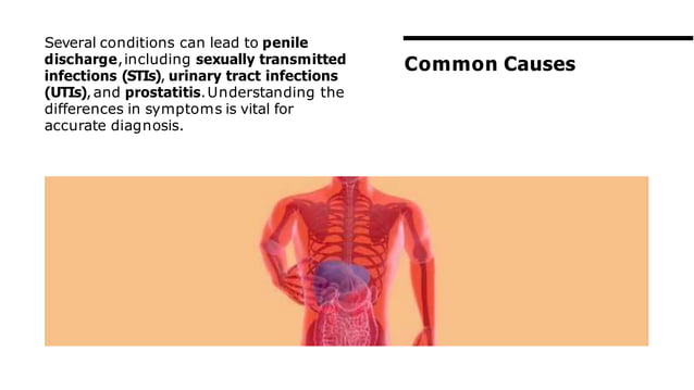 understanding-penile-discharge-testing-and-diagnosis-20240115045012vWoT ...