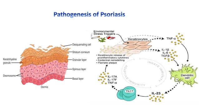 Understanding-Psoriasis-The-Gut-Skin-Axis 5.pptx