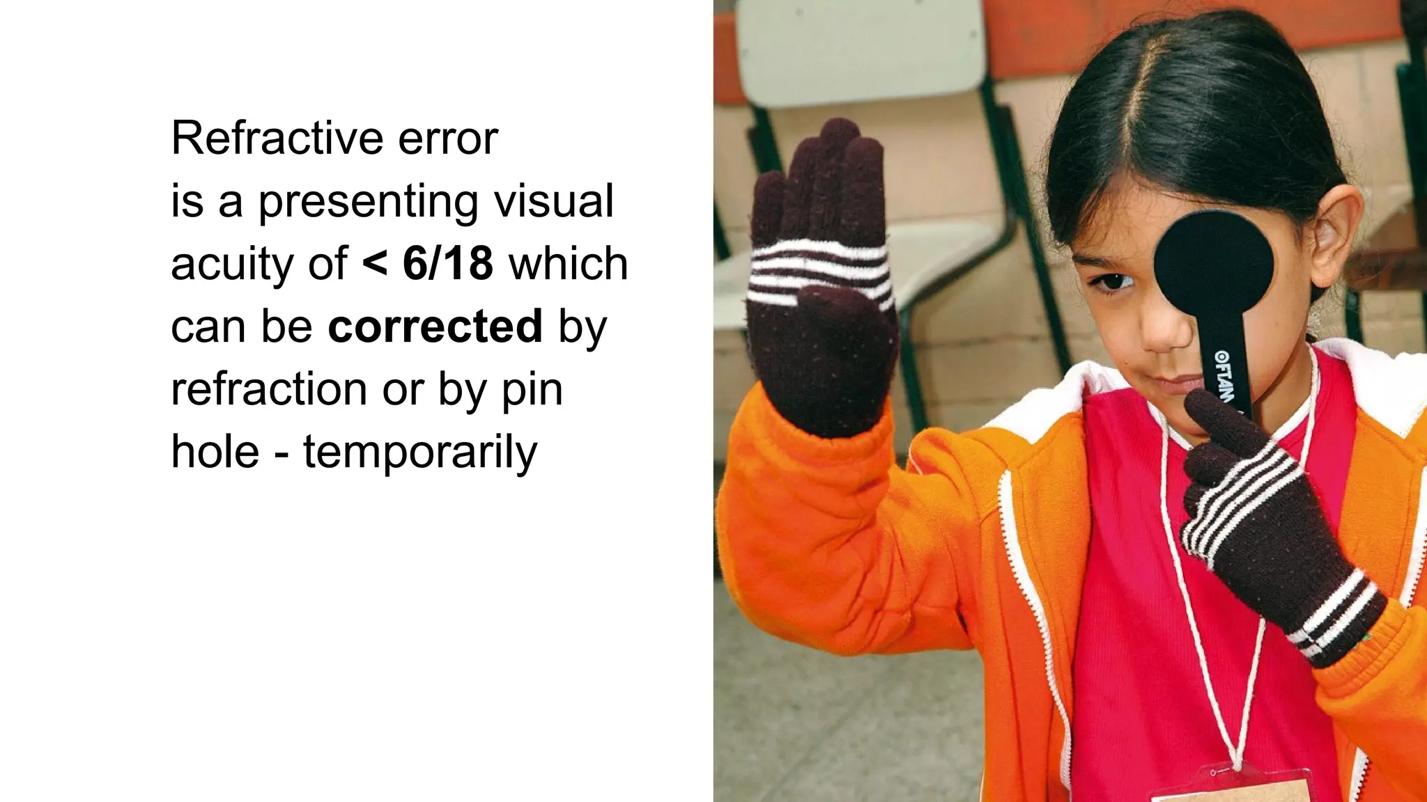 Global Blindness: Understanding refractive error | PPT