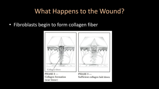 Understanding-Sutures-and-Basic-flap-design.pdf
