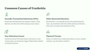 Understanding-Urethritis. Inflammation of ureter | PDF