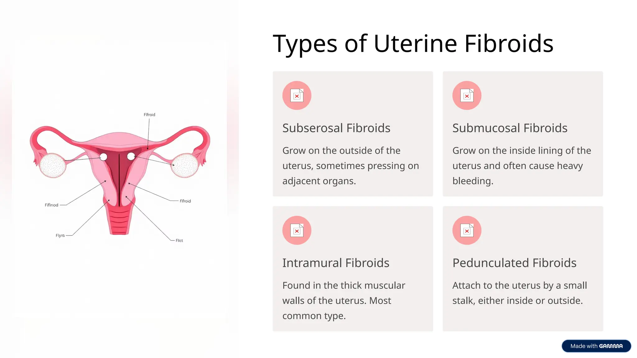 Uterine Fibroids: Types, Warning Signs & Key Risks | PPTX