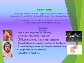 UNDERSTANDING Of ANAPHYLAXIS.pptx