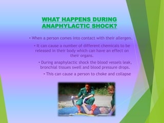 UNDERSTANDING Of ANAPHYLAXIS.pptx
