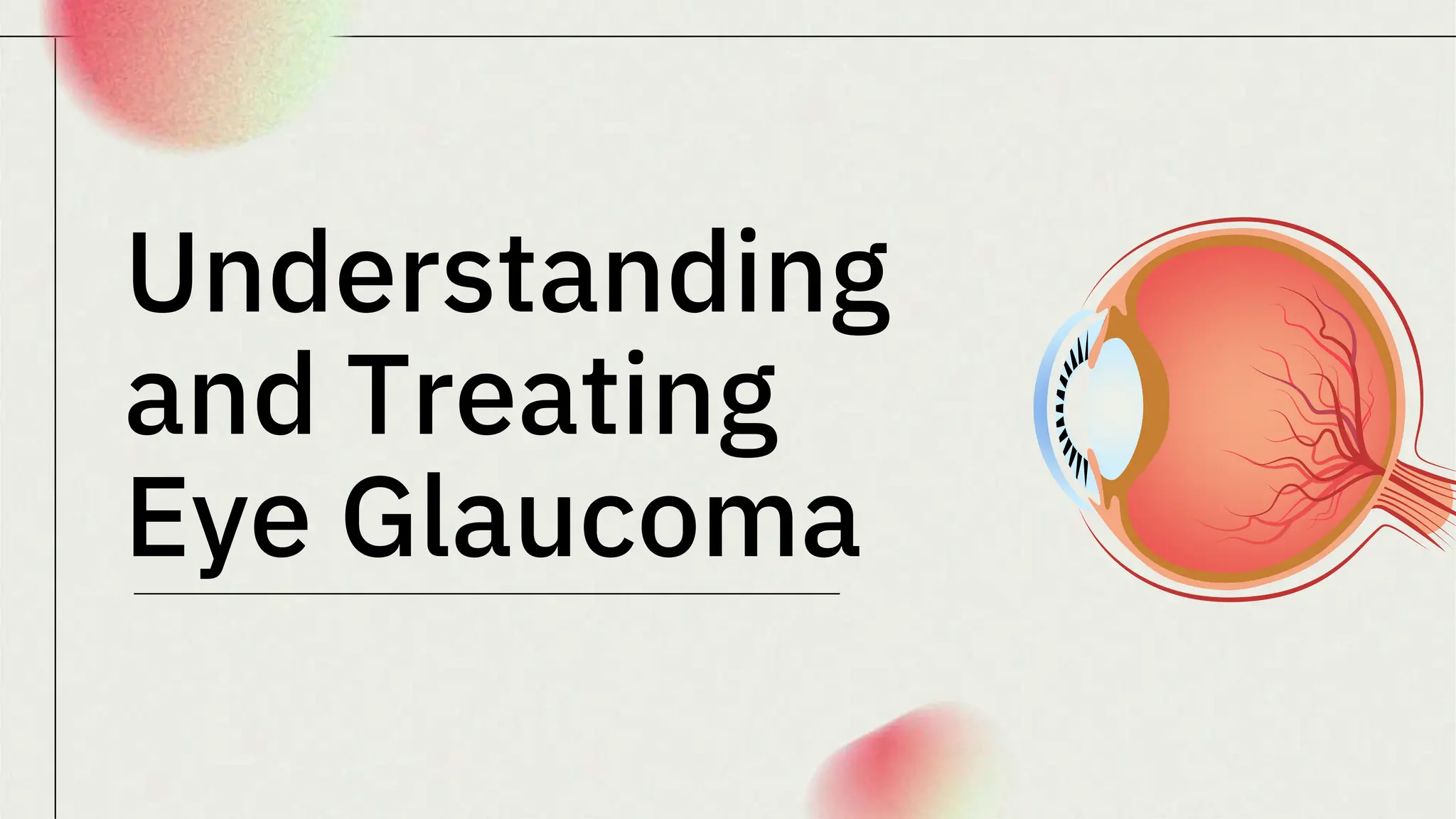 Understanding and Treating Eye Glaucoma | PPTX