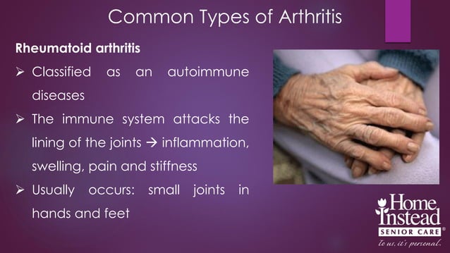 Understanding Arthritis | PPT