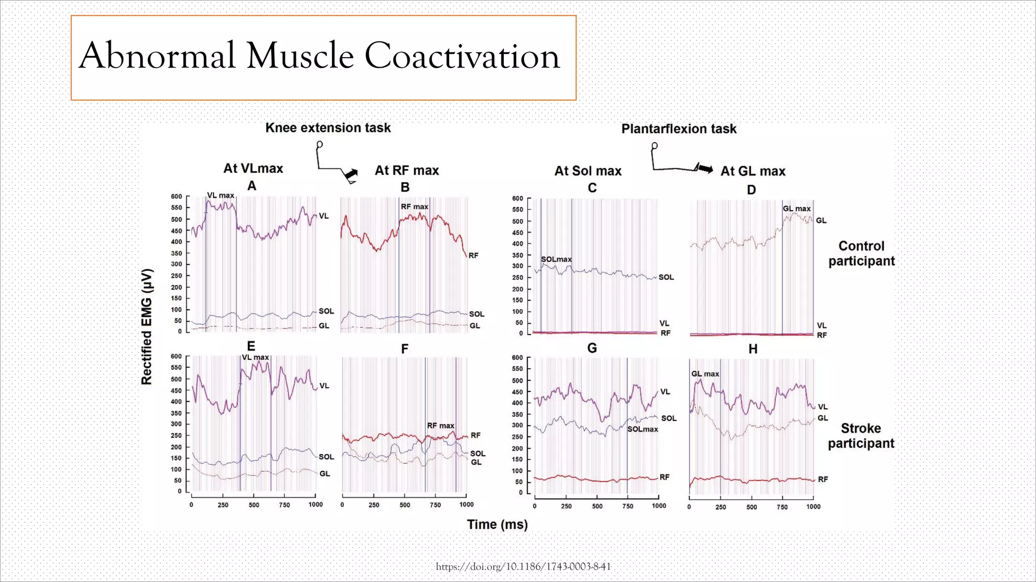 Understanding Basic Concept of Muscle Tone & Functional.pdf