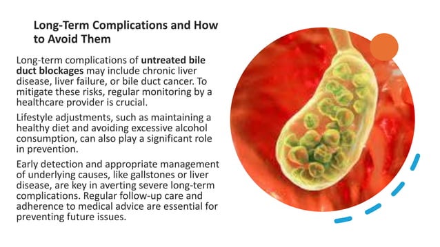 Understanding Blocked Bile Duct Symptoms.pdf