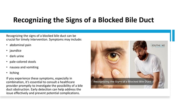 Understanding Blocked Bile Duct Symptomspdf