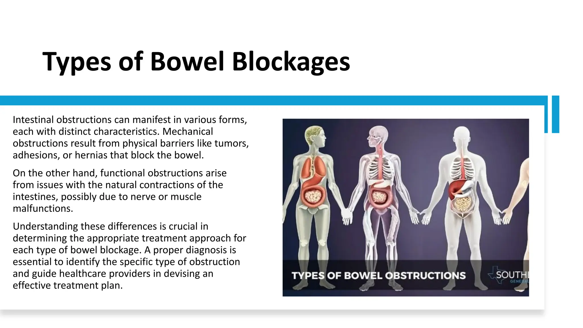 Understanding Bowel Blockage Operation - Symptoms & Solutions.pdf