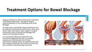 Understanding Bowel Blockage Operation - Symptoms & Solutions.pdf