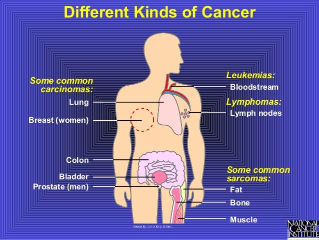 Understanding cancer -_what_is_cancer_edited
