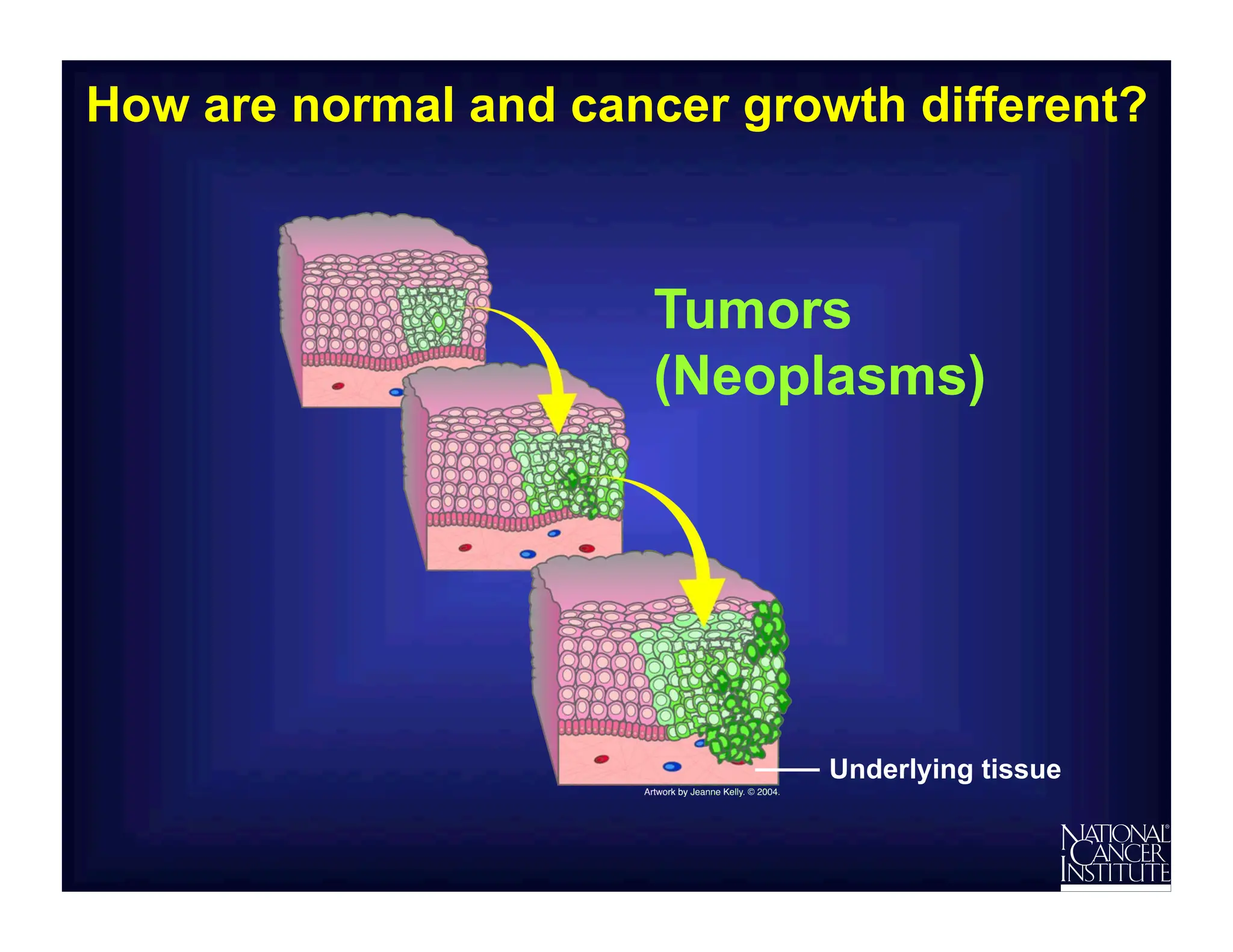 Basics of cancer and its types and its prevention | PDF | Cancer ...
