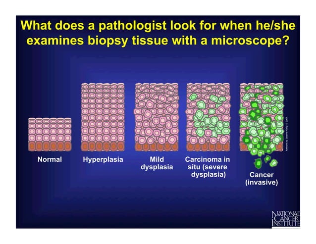 Basics of cancer and its types and its prevention | PDF | Cancer ...