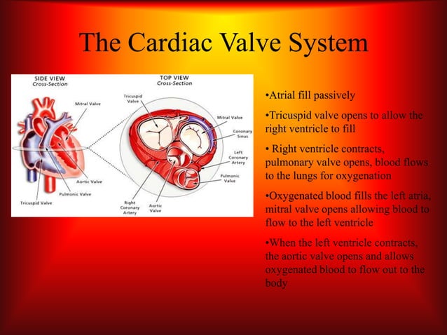 Understanding Cardiac Auscultation | PPT