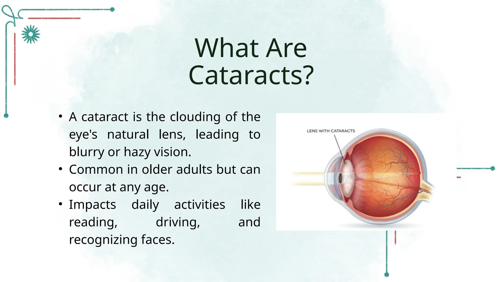 Understanding Cataracts: Symptoms & Treatment | PPT