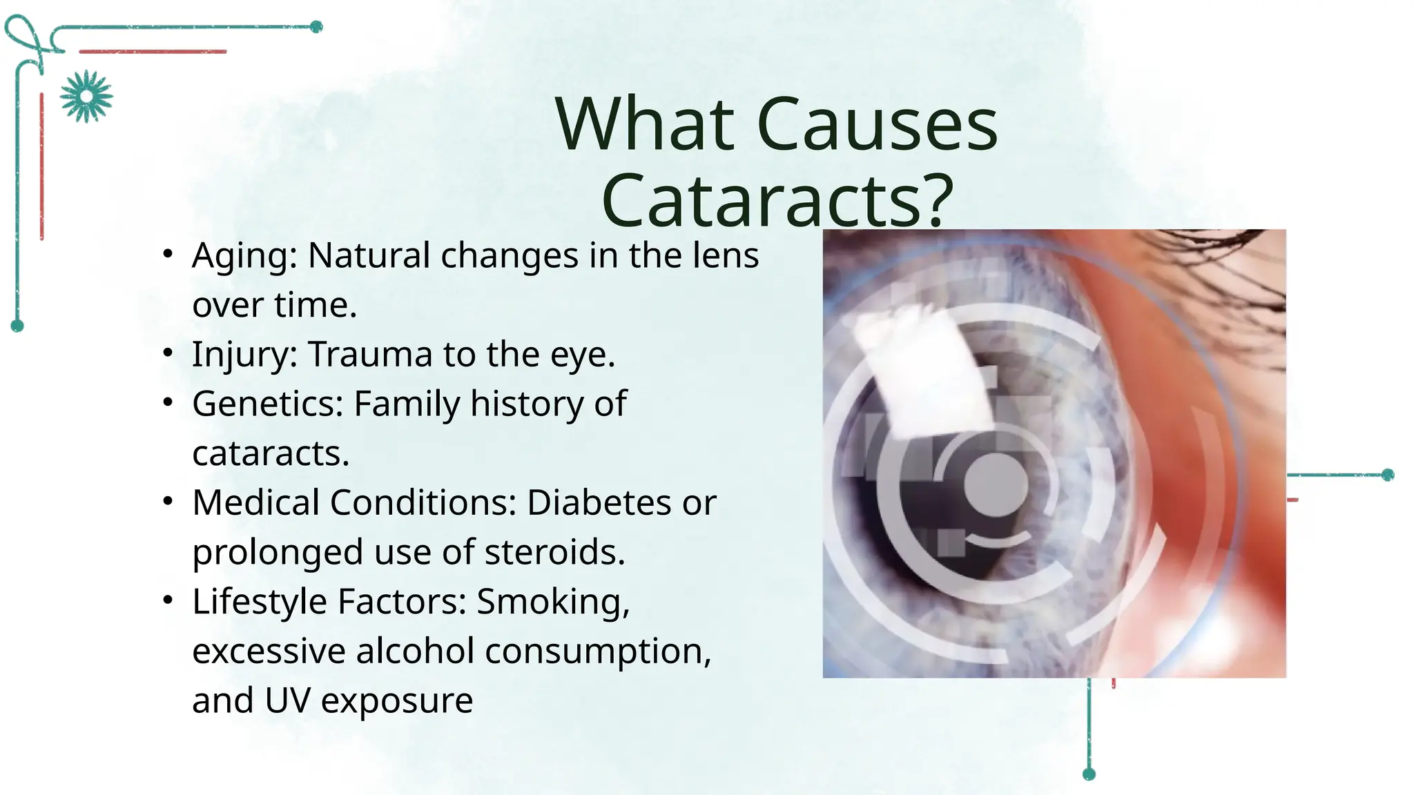 Understanding Cataracts: Symptoms & Treatment | PPT