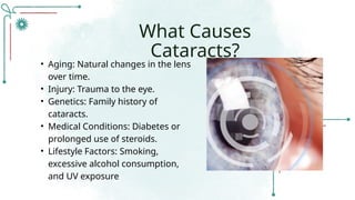 Understanding Cataracts: Symptoms & Treatment | PPTX