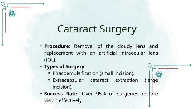 Understanding Cataracts: Symptoms & Treatment | PPT