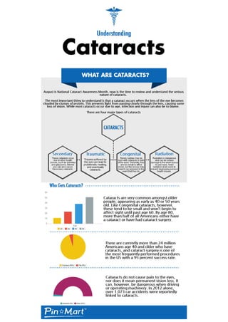 Understanding Cataracts | PDF