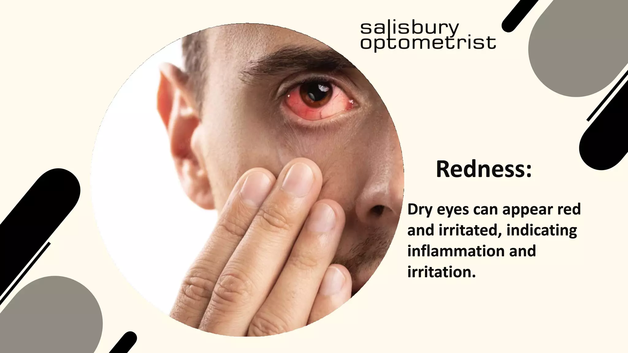Understanding Cataract Symptoms, Dry Eye Syndrome, and Pink Eye ...