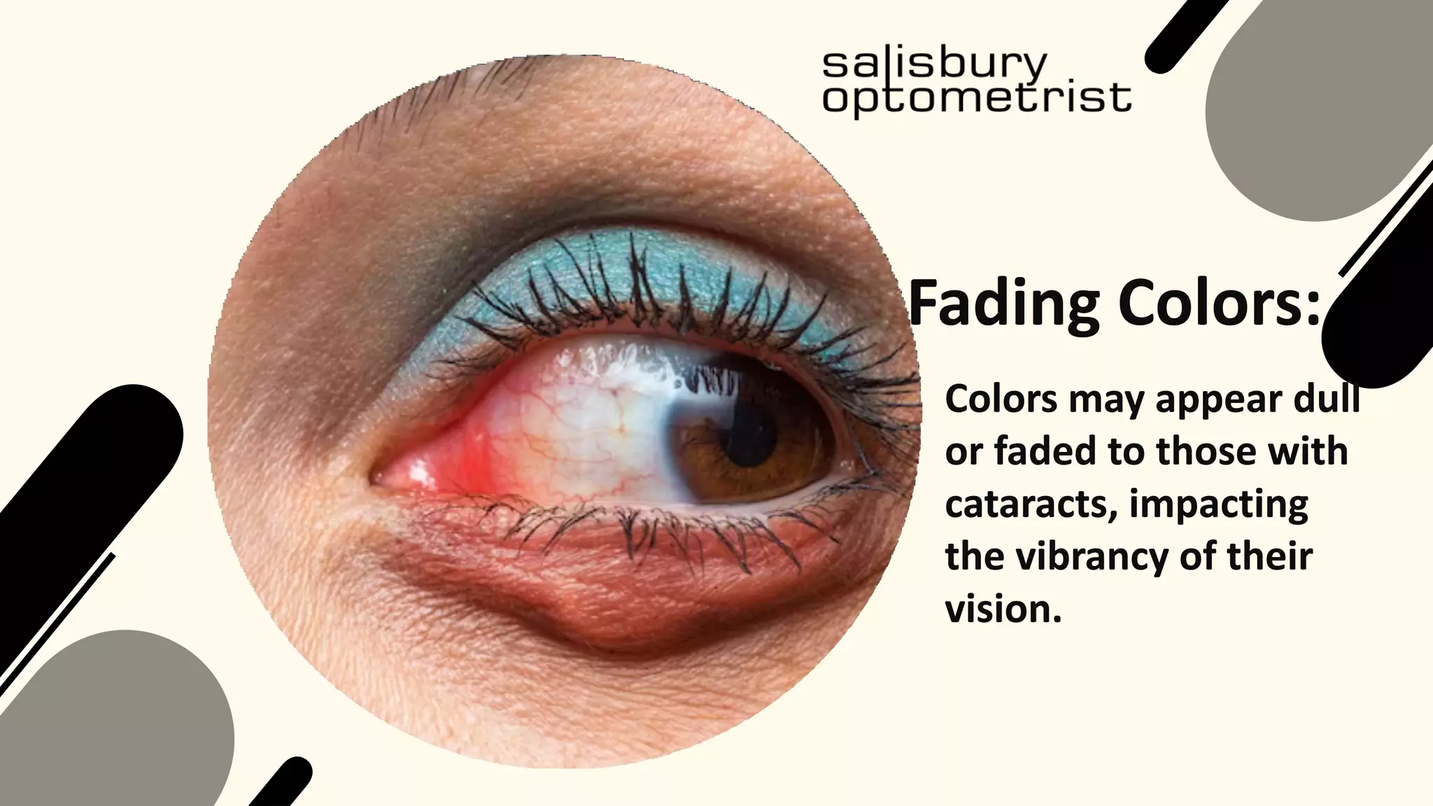 Understanding Cataract Symptoms, Dry Eye Syndrome, and Pink Eye ...