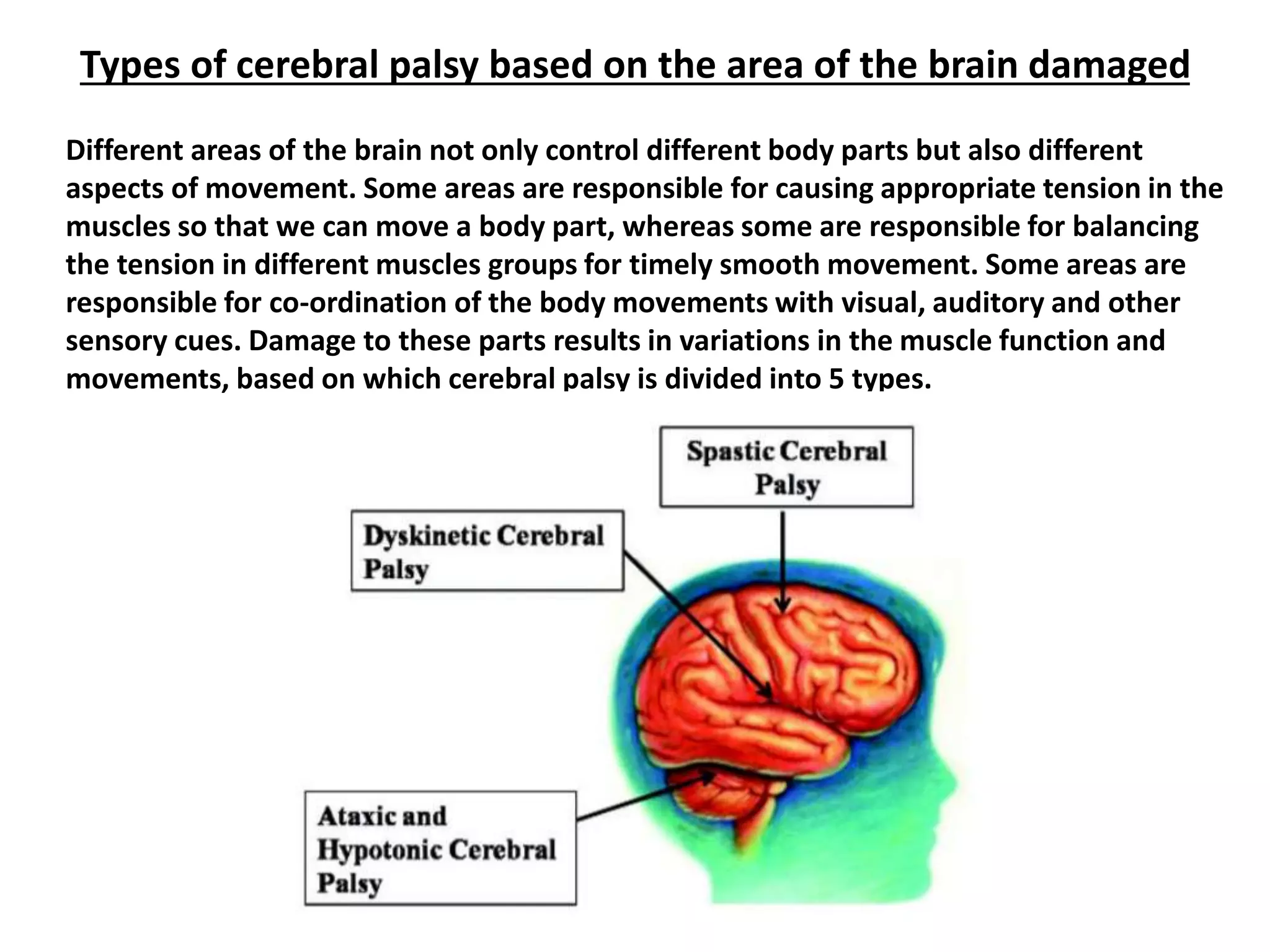Understanding cerebral palsy | PPT