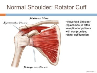 Understanding Chronic Shoulder Pain | PPT