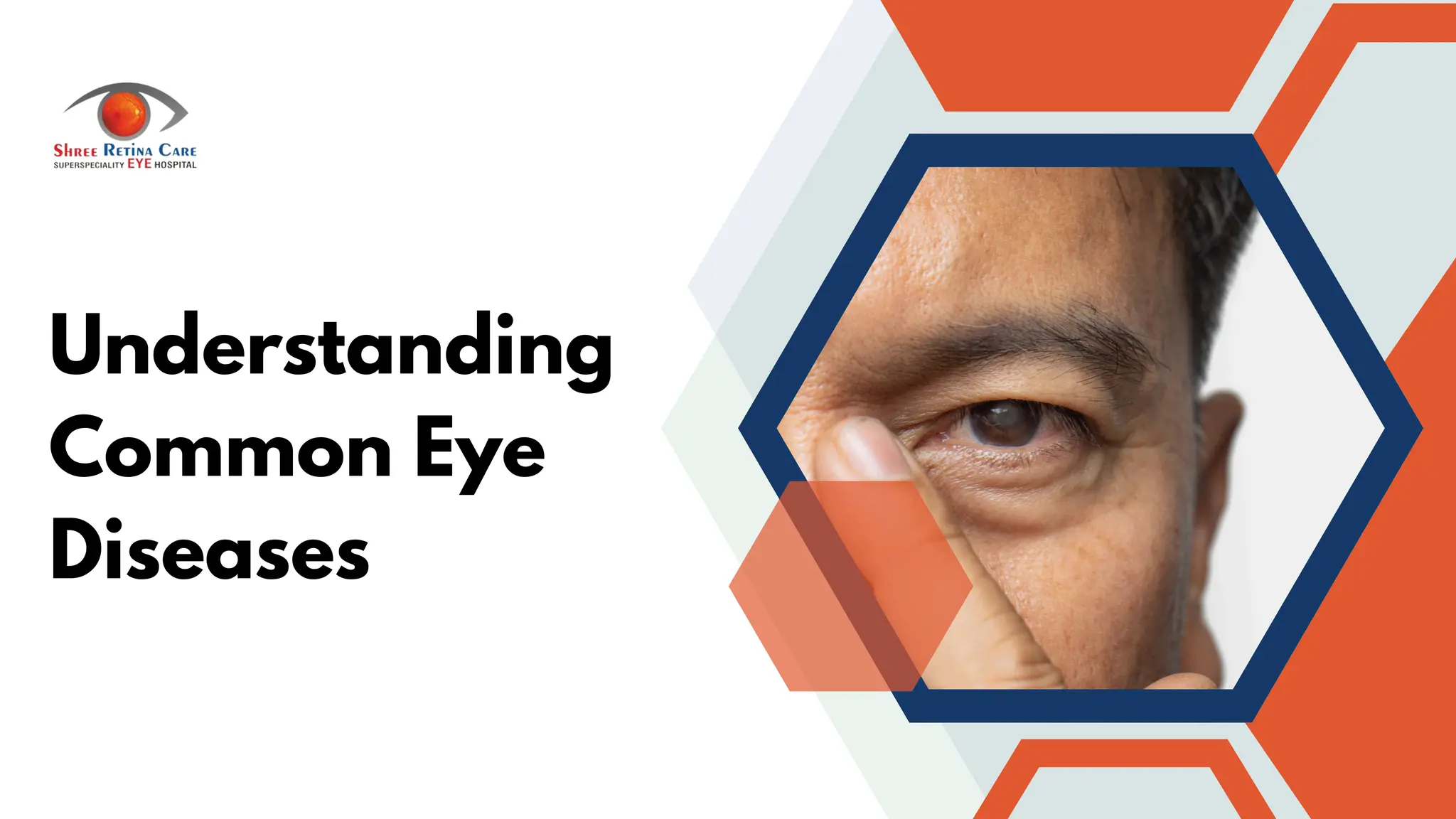 Understanding Common Eye Diseases - - | PDF