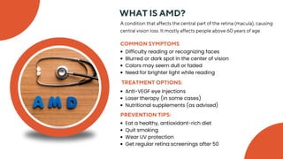 Understanding Common Eye Diseases Signs, Symptoms & Solution.pdf