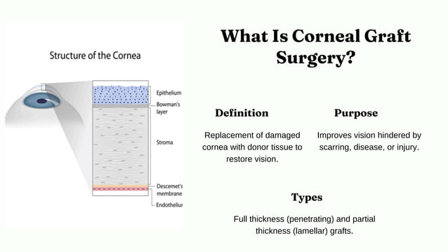 Understanding Corneal Graft Surgery by Nexus Eye Care | PDF