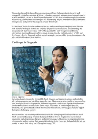 Creutzfeldt-Jakob Disease: Causes, Symptoms, and Treatment | The ...