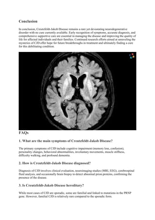 Creutzfeldt-Jakob Disease: Causes, Symptoms, and Treatment | The ...