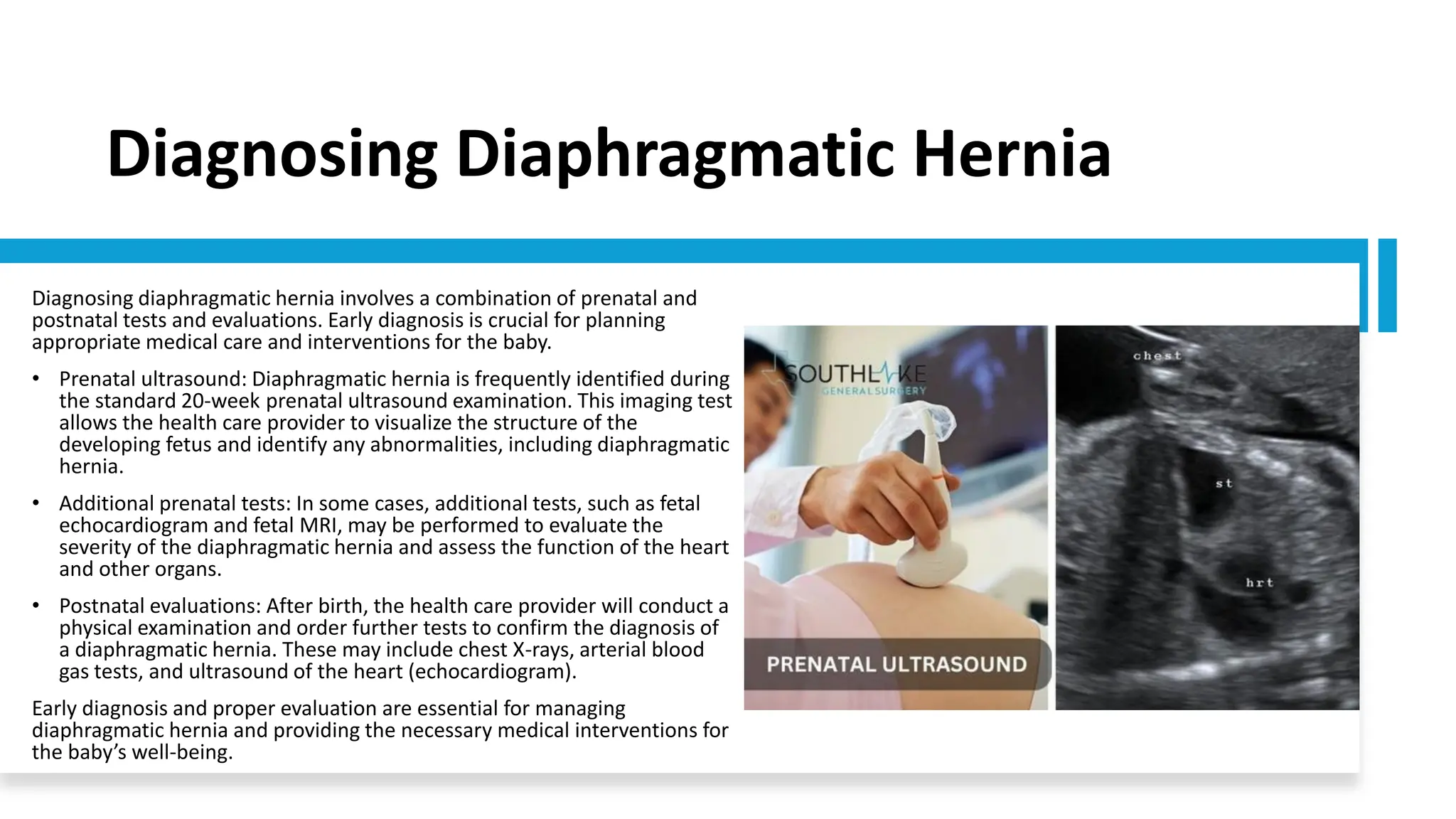 Understanding Diaphragmatic Hernia - Symptoms & Causes.pdf