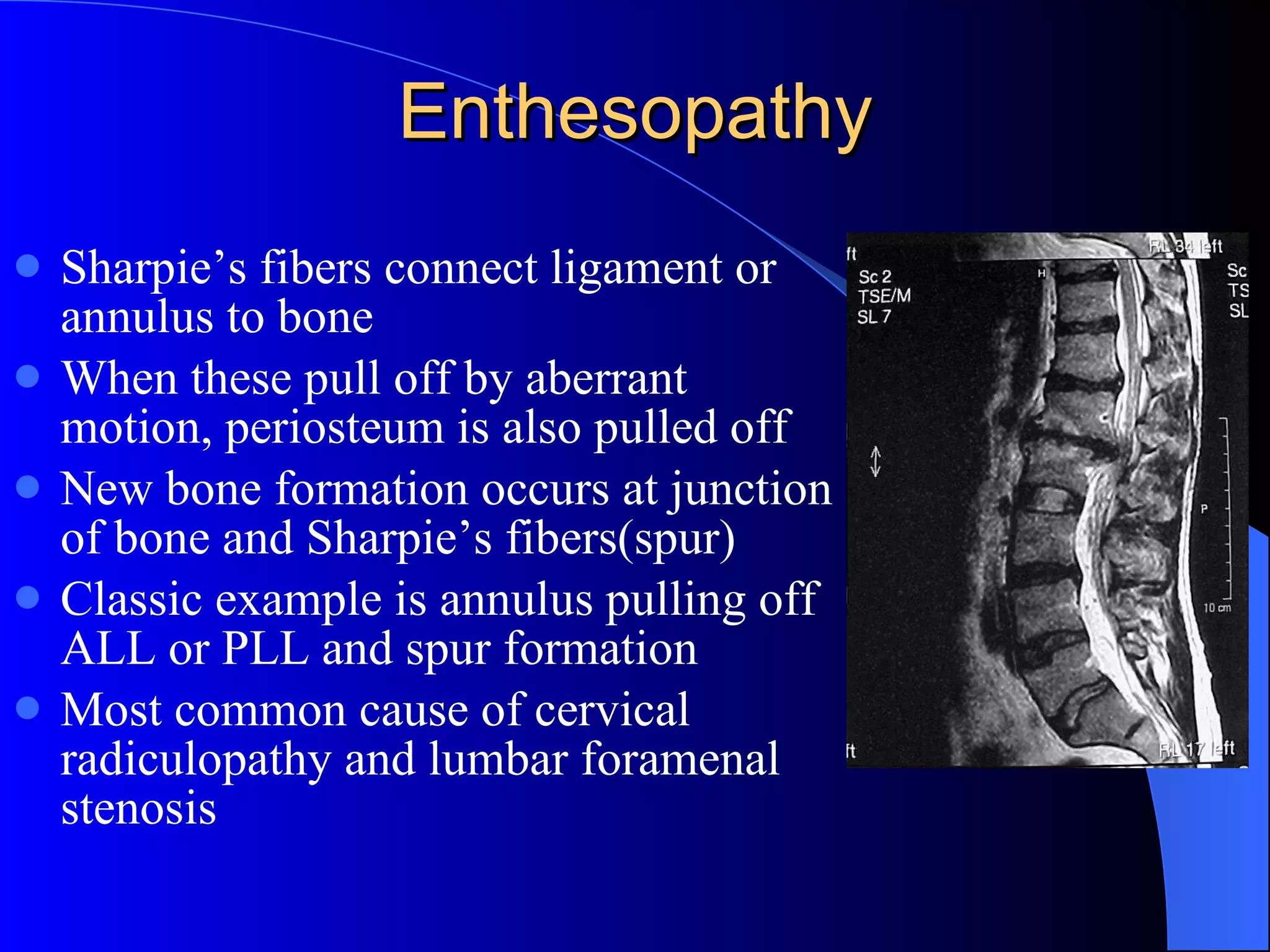 Understanding disorders of the spine| anatomy of the spine | chronic ...