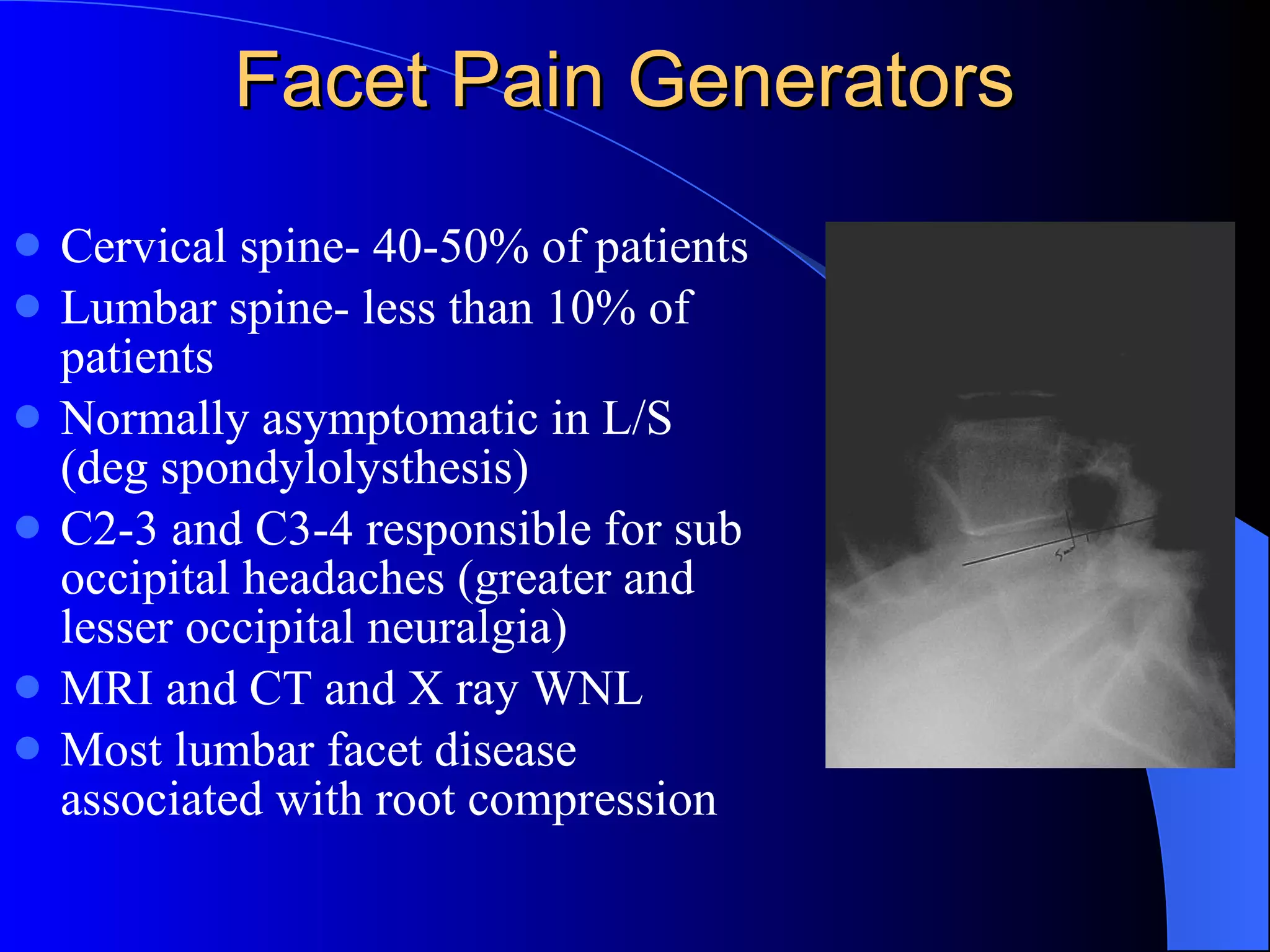 Understanding disorders of the spine| anatomy of the spine | chronic ...