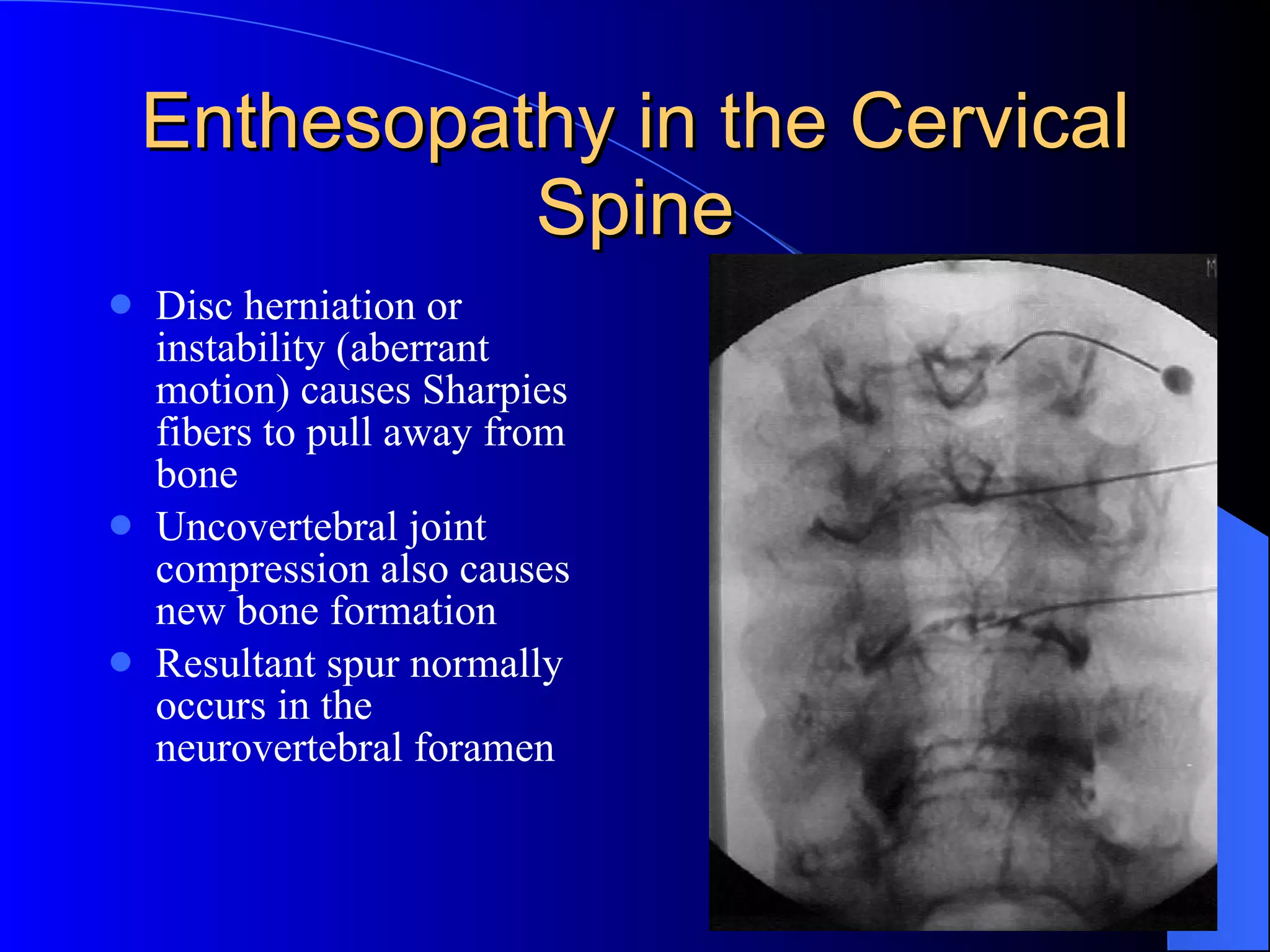 Understanding disorders of the spine| anatomy of the spine | chronic ...