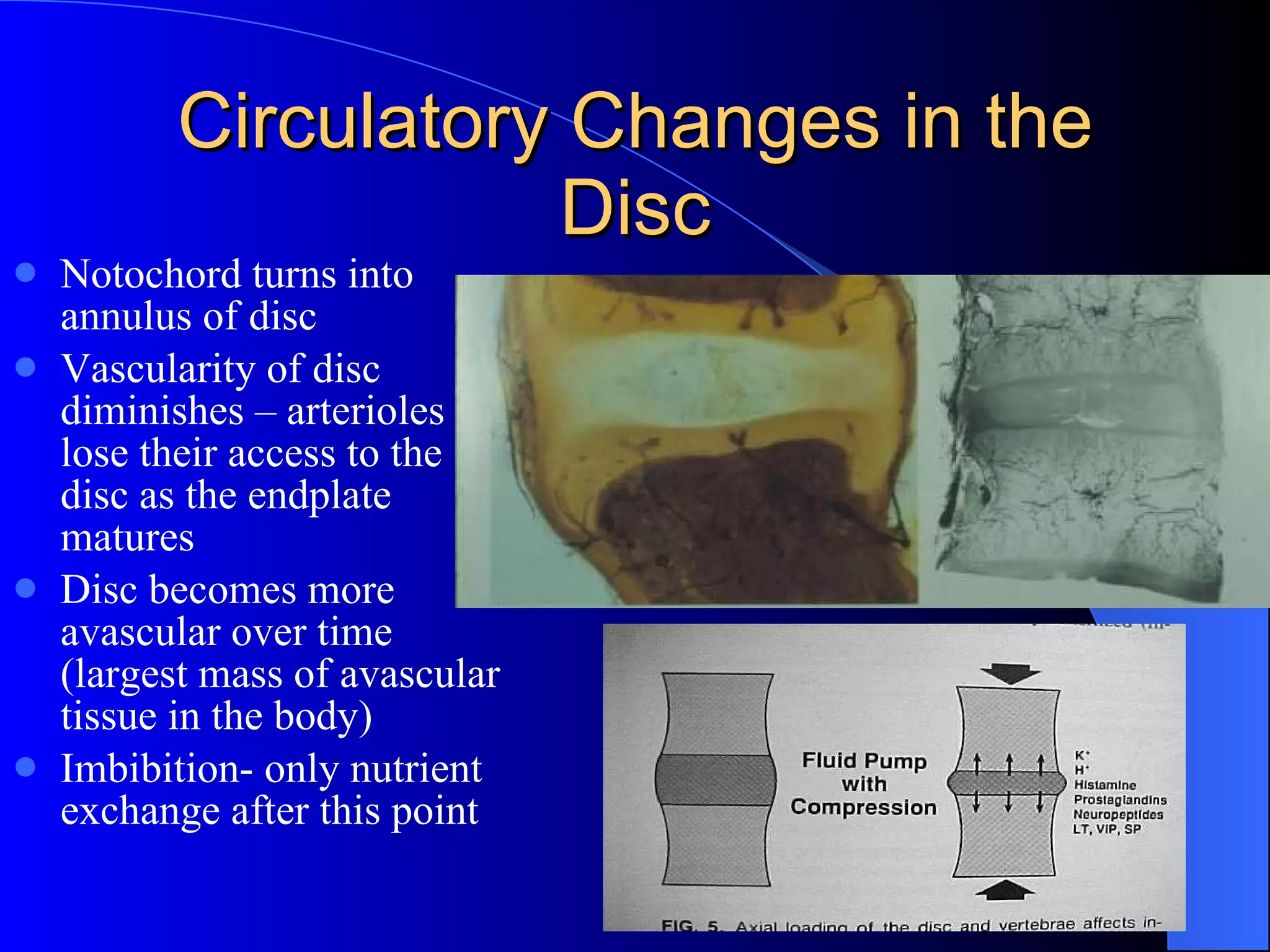Understanding disorders of the spine| anatomy of the spine | chronic ...