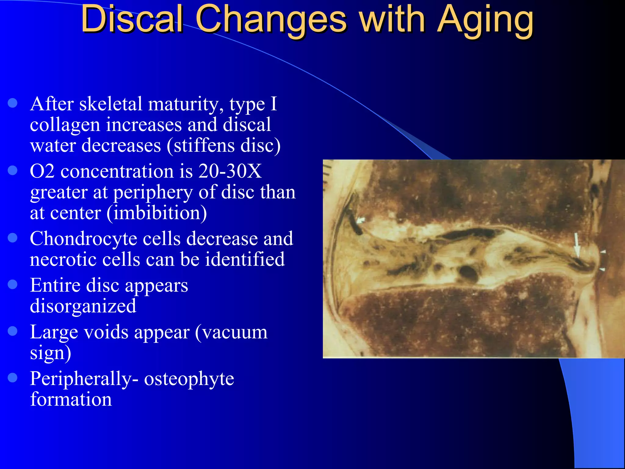 Understanding disorders of the spine| anatomy of the spine | chronic ...