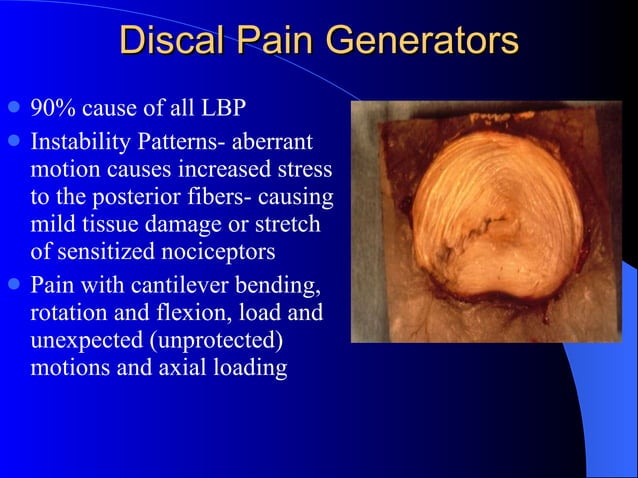Understanding disorders of the spine| anatomy of the spine | chronic ...