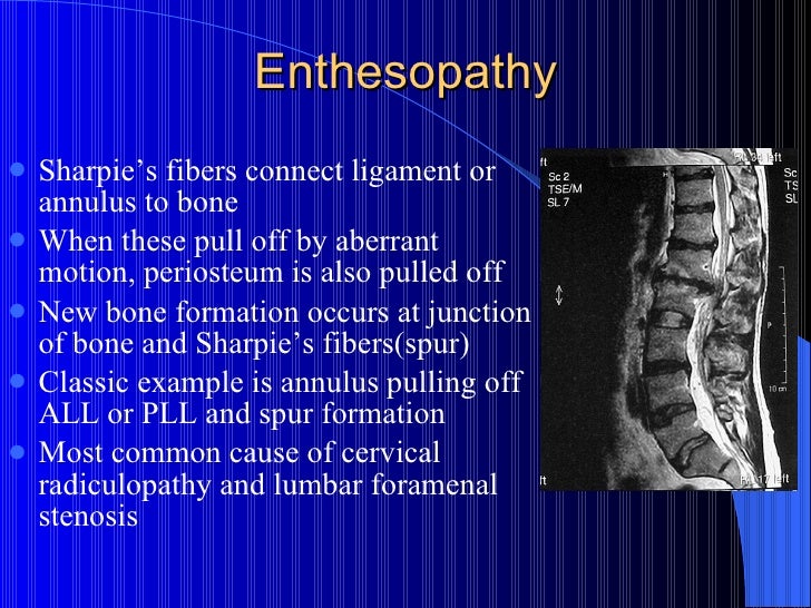 Understanding disorders of the spine| anatomy of the spine | chronic