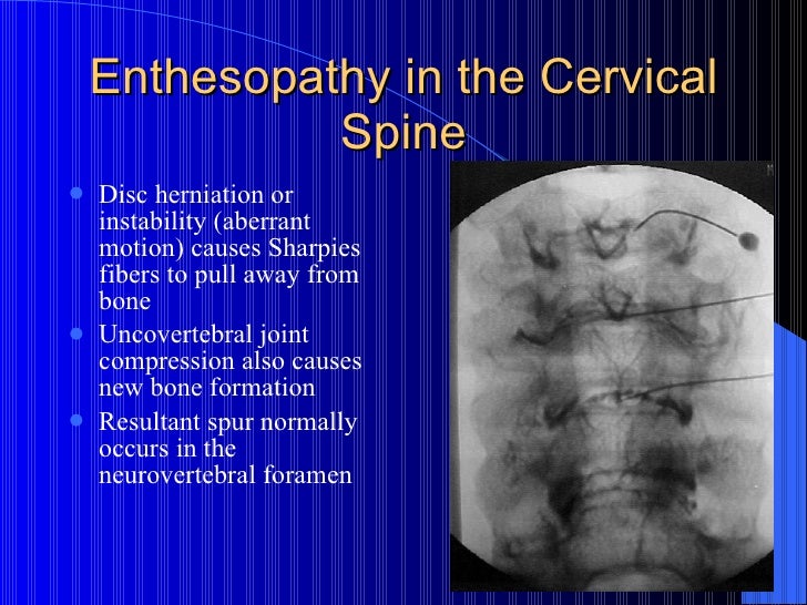 Understanding disorders of the spine| anatomy of the spine | chronic