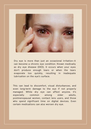 Understanding Dry Eye: A Common but Often Overlooked Condition | PDF