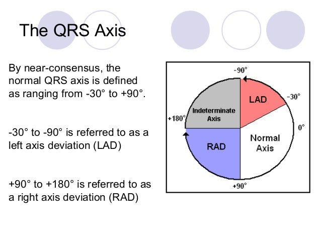 Understanding ecg