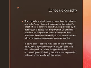 Understanding Echocardiography | PPT