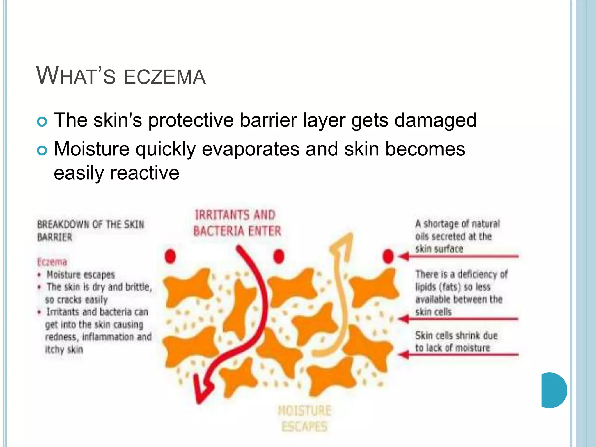 Understanding eczema | PPT
